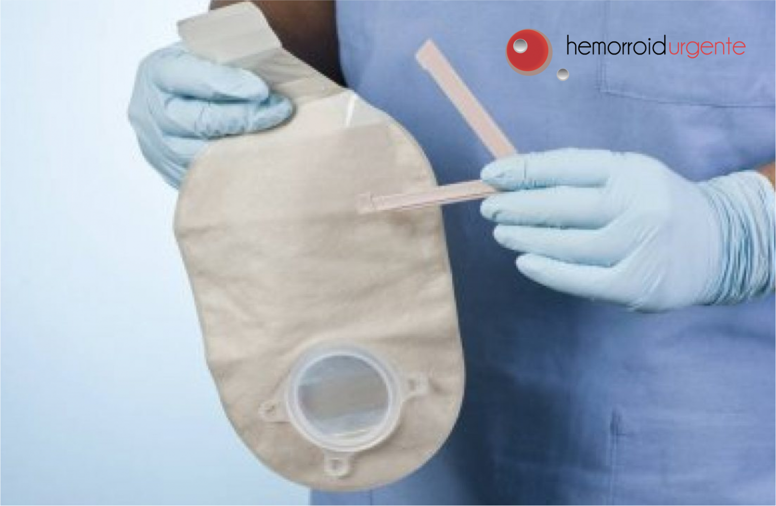 VIDA NORMAL COM BOLSA DE COLOSTOMIA? – Hemorroidurgente